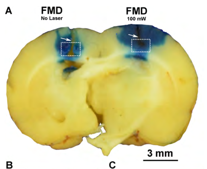 Projects – Medical Design Innovations Laboratory